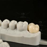 China Multilayer Zirconia Full Ceramic Crown Customizable Zirconia Restorations for sale