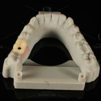 China China Dental Lab One-Piece Integrated Implant Crown for sale