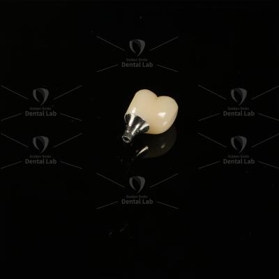 China China Dental Lab One-Piece Integrated Implant Crown for sale