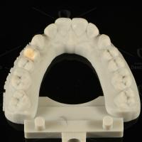 China China Dental Lab IPS e.max Lithium Disilicate Inlay & Onlay for sale