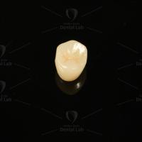 China Cobalt-Chromium Post & Core with Layered Zirconia Full Crown for sale