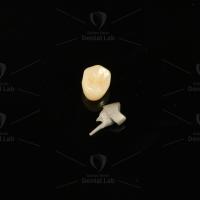 China Cobalt-Chromium Post & Core with Layered Zirconia Full Crown for sale