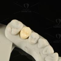 China Cobalt-Chromium Post & Core with Layered Zirconia Full Crown for sale