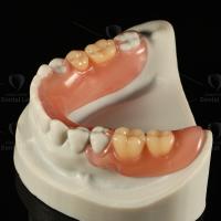 China Full Acrylic Resin Removable Partial Denture for sale