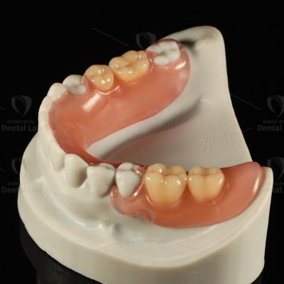 China Full Acrylic Resin Removable Partial Denture for sale