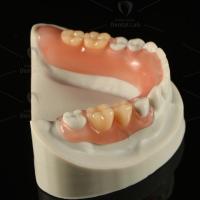 China Full Acrylic Resin Removable Partial Denture for sale