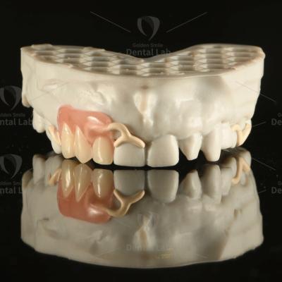 China PEEK Removable Partial Denture | Metal-Free & Comfort RPD for sale