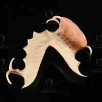 China PEEK Removable Partial Denture | Metal-Free & Comfort RPD for sale