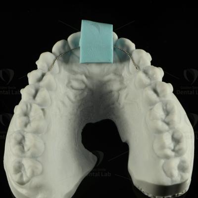 China Custom Lingual Twist Wire Retainer for Post-Ortho Treatment for sale