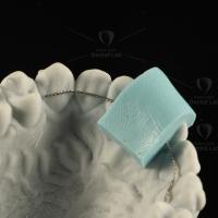 China Custom Lingual Twist Wire Retainer for Post-Ortho Treatment for sale