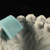 China Custom Lingual Twist Wire Retainer for Post-Ortho Treatment for sale