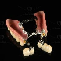 China Bridge with Ball Cap Attachments & Metal Framework for sale