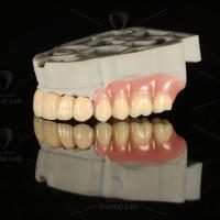 China Bridge with Ball Cap Attachments & Metal Framework for sale