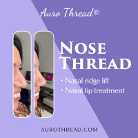 China Class III Adults Magik Nose Lift 19g 38mm  Medical Absorbable Suture Pdo Thread for sale