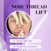 China Class III Adults Magik Nose Lift 19g 38mm  Medical Absorbable Suture Pdo Thread for sale