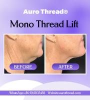 China Facial Beauty Lift Mono 29G 60mm Tensores Fio V Line Face Lift Pdo Thread for sale