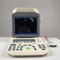 China All-Digital B/W Ultrasound System with 12.1