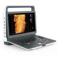 China Portable 4D Ultrasound Machine with 15