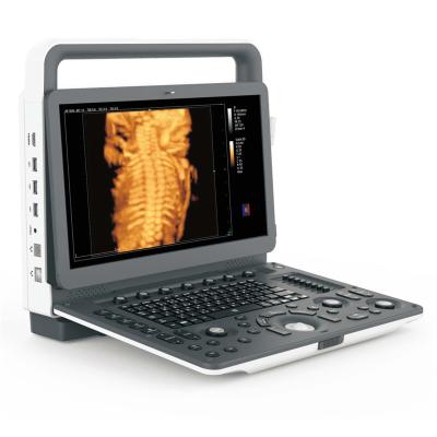 China Portable 4D Ultrasound Machine with 15