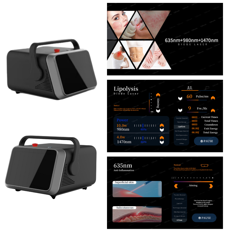 980nm 1470nm 635nm Laser Equipment for Pain Relief and Lipolysis