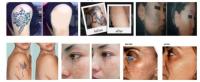 China Desktop Picosecond Laser Machine 755nm 1064nm 532nm 1320nm  For Carbon Peeling for sale
