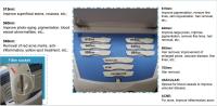 China GOMECY Laser Multifunction Beauty Machine M22 IPL SHR Laser Hair Removal Machine for sale