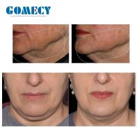 China pulse electromagnetic for face beauty RF EMS Sculpting Machine 3 Handles Facial Firming Cheeks for sale