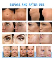 China Professional RF Microneedling Machine With RF Radiofrecuent CE approved for sale