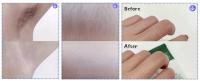 China IPL Intense Pulsed Light Hair Removal Machine GMS M22 Pigmentation Removal Laser Machine for sale