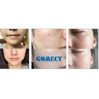 China 650-950nm / 560-950nm Laser Multifunction Beauty Machine For Skin Rejuvenation for sale