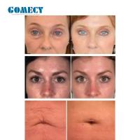 China Vertical 2 In 1 Skin Tightening Morpheus 8 Machine / Morpheus Microneedling Machine for sale