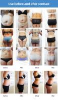 China 940nm 635nm Lipo Laser Slimming Machine For Weight Loss / Pain Therapy for sale