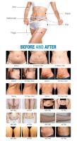 China Non Invasive Lipo Laser Slimming Machine 5 Wavelength 808nm Infrared Body Sculpting Machine for sale