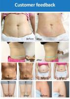 China Green Light 10D Lipo Laser Slimming Machine With 532nm Cold Source Laser for sale