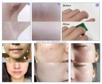 China IPL Intense Pulsed Light Machine Hair Removal Skin Rejuvenation Beauty Equipment for sale