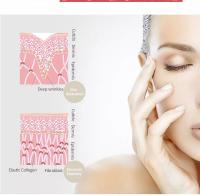China 1550nm Er Yag Laser Machine Erbium Glass Fractional Laser Resurfacing Machine for sale