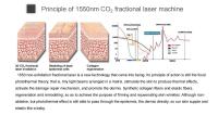 China 1550nm Er Yag Laser Machine Erbium Glass Fractional Laser Resurfacing Machine for sale