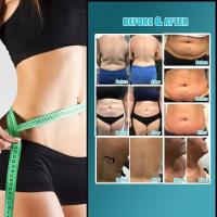 China Weight Loss Vela Slimming Machine 100W Cavitation RF Vacuum Slimming Machine for sale