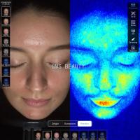 China Advanced Face Analyzer Machine For Accurate Skin Analysis And Detection Of Skin Problems for sale