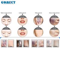 China Popular Nd Yag Tattoo Removal Laser Machine For Skin Whitening for sale