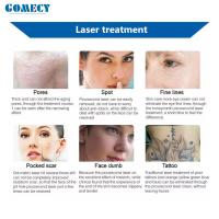 China Popular Nd Yag Tattoo Removal Laser Machine For Skin Whitening for sale