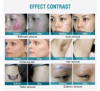 China Gomecy Carbon Laser Peel Machine Whitening Face Ndyag Laser Machine For Beauty Care for sale