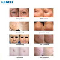 China 10.6μM Fractional CO2 Laser Skin Resurfacing Machine With True Color Touch LCD Screen for sale
