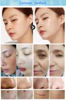 China Hydra Dermabrasion Machine 200W Diamond Peeling Microdermabrasion Machine 8 In 1 for sale