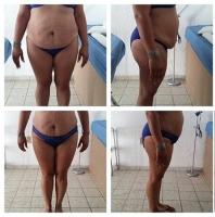 China 2023 6 In 1 Professional Laser Lipo Body Slimming Tummy Fat Loss Salon Beauty Machine for sale