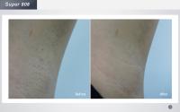 China 755+808+1064nm All In One Diode Laser Machine For Industrial Salon Laser Hair Removal for sale
