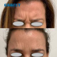 China PE-Face Facial Muscle Stimulation muscle focused for face antiage High Intensity Electromagnetic EMS Heating for sale