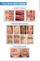 China Fractional Laser Skin Treatment Scar Stretch Marks Removal Co2 Fractional Laser Vagi Tightening Machine for sale
