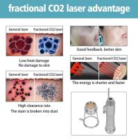 China GOMECY 2024  Facial Skin Care Co2 Fractional Laser Stretch Mark Fractional Co2 Laser For Warts Scars Birthwarks Removal for sale