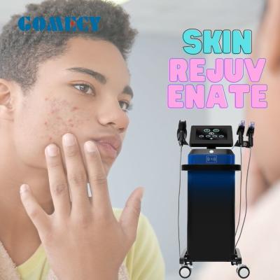 China 2024 Morpheus 8 Fractional Radiofrequency Microneedling Fractional Rf Skin Tightening Acne Fractional Rf Skin Rejuvenate for sale
